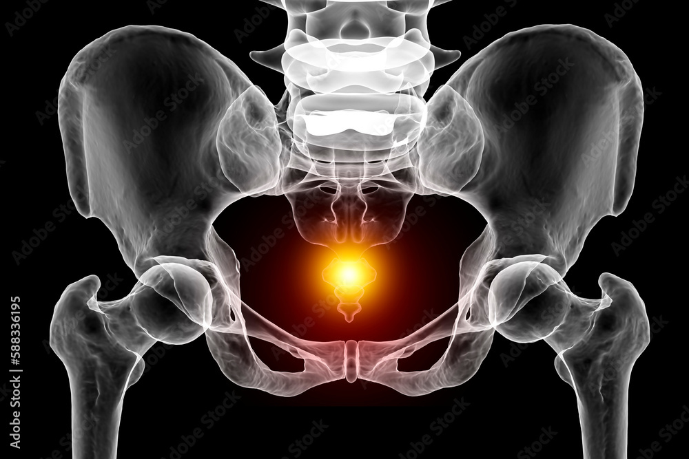 A 3D medical illustration highlighting the coccyx bone marked in red ...