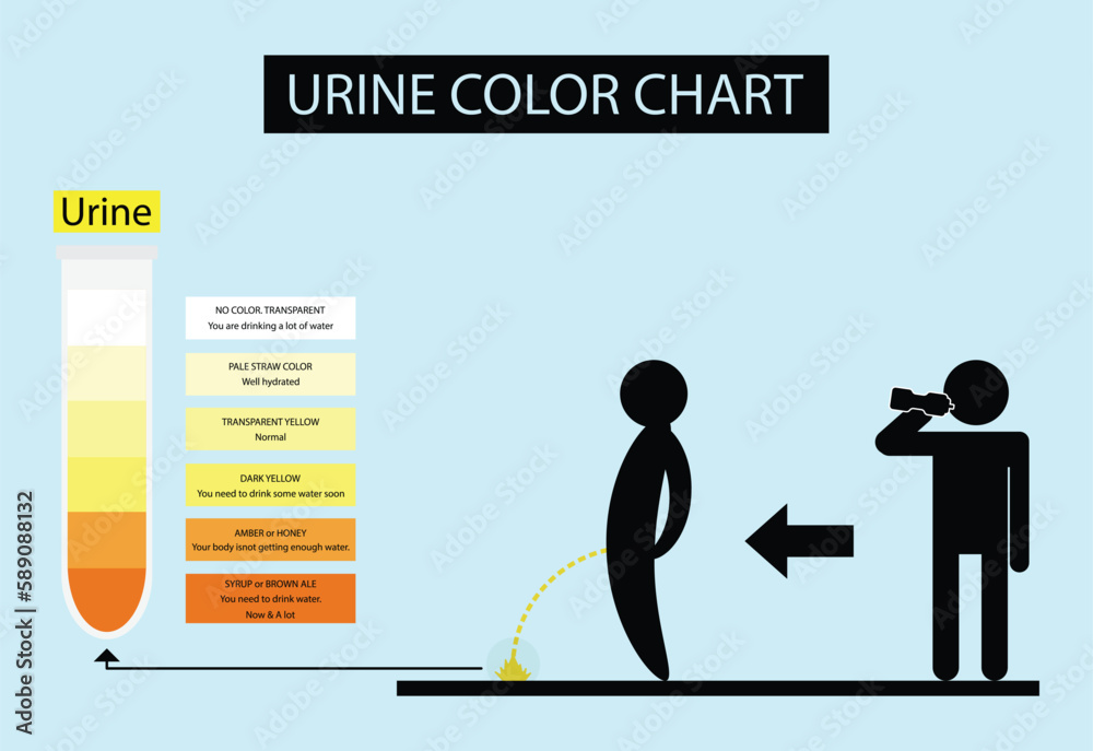 illustration of biology, Urine color chart, The color of urine can tell ...