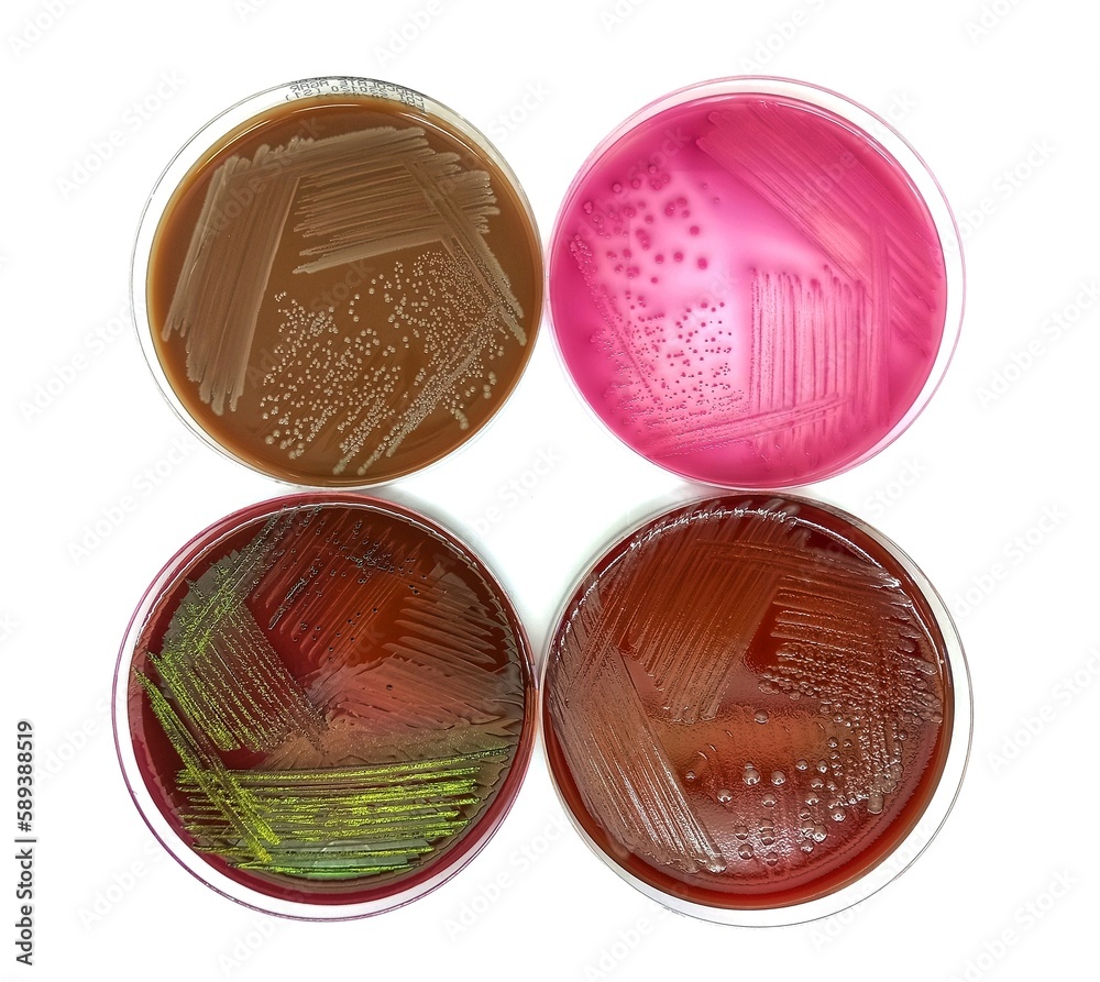 Escherichia coli colonies in MacConkey agar plate, Blood agar plate ...