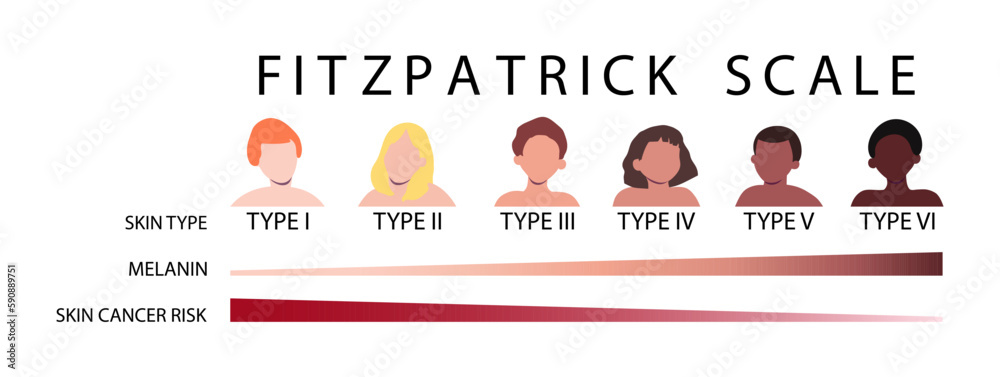 Fitzpatrick scale. Skin types infographic with male and female faceless ...