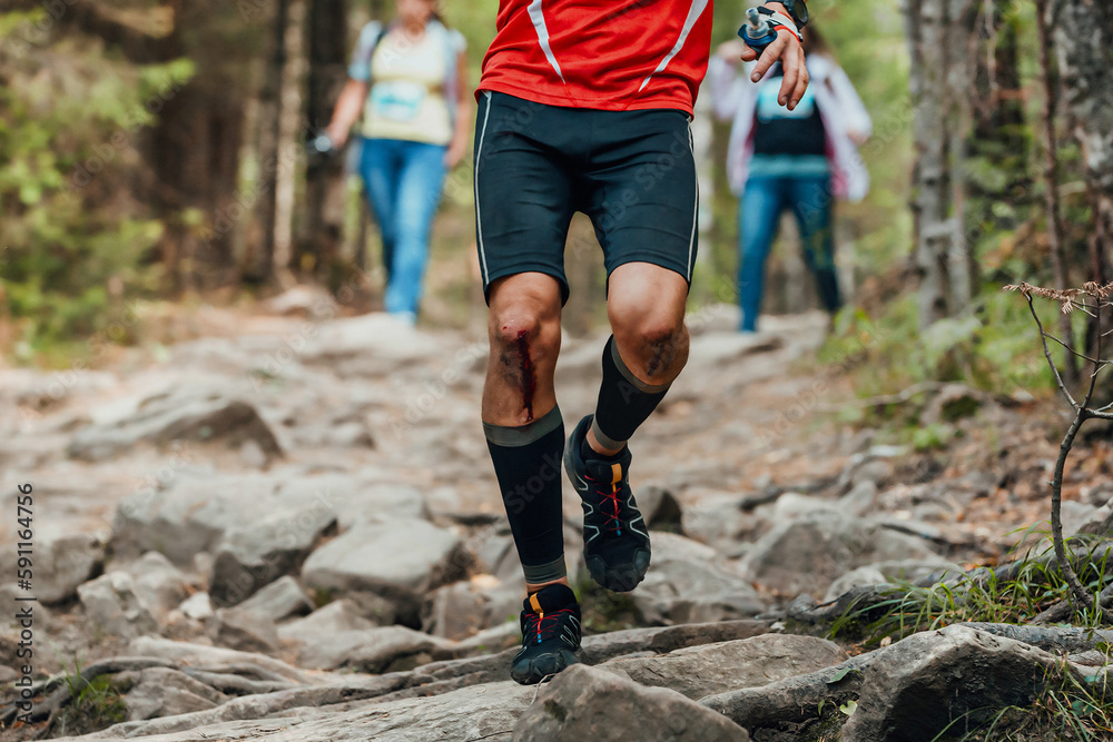 male runner in compression sleeves running forest trail race over ...