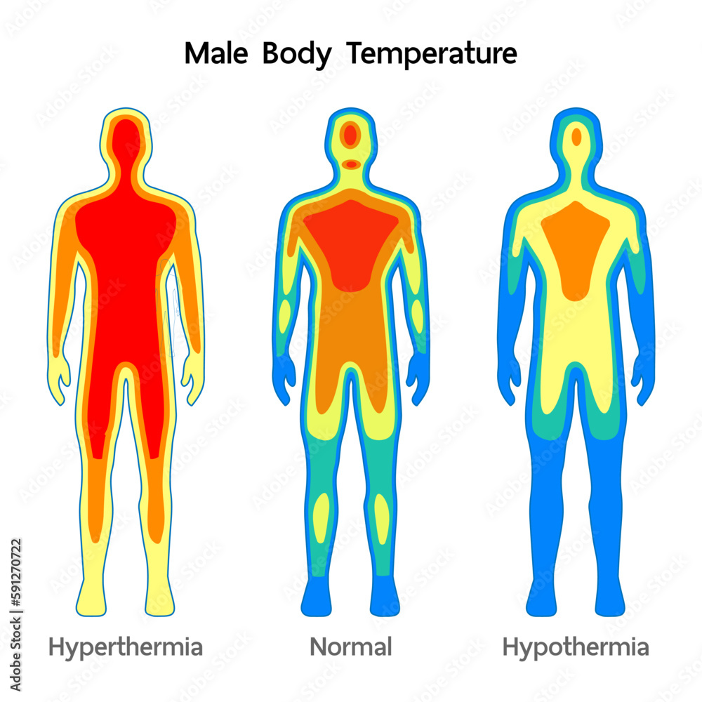 Body Temperature Diagram