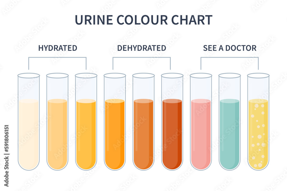 Vector de Stock Urine colour chart. Hydration and dehydration level ...