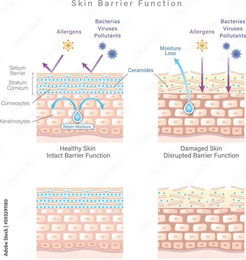 Skin anatomy/cross-section diagram explaining the skin barrier function ... Skin anatomy/cross-section diagram explaining the skin barrier function ...