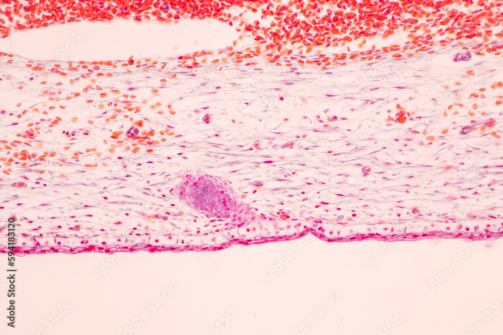 Anatomy and Histological Bone, Elastic cartilage human and Joint of ...