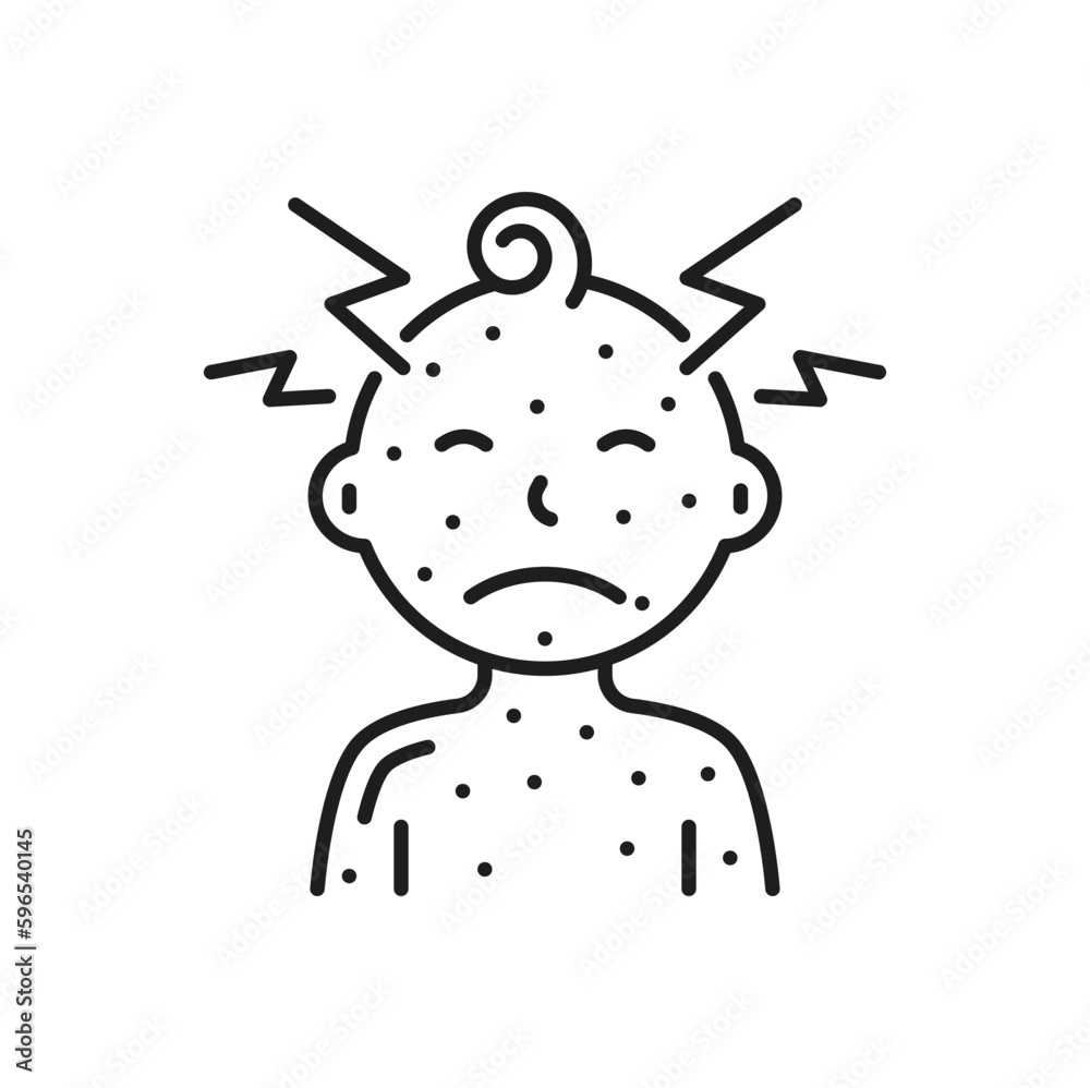 Baby boy with chickenpox and head ache, skin rash, hives, irritation ...