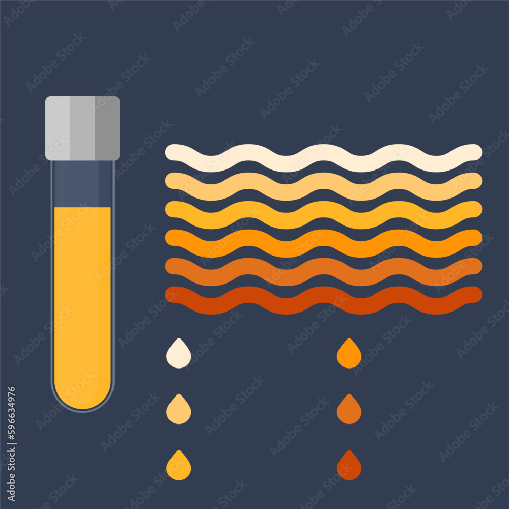 Urine colour chart. Hydration and dehydration level diagram. Medical ...