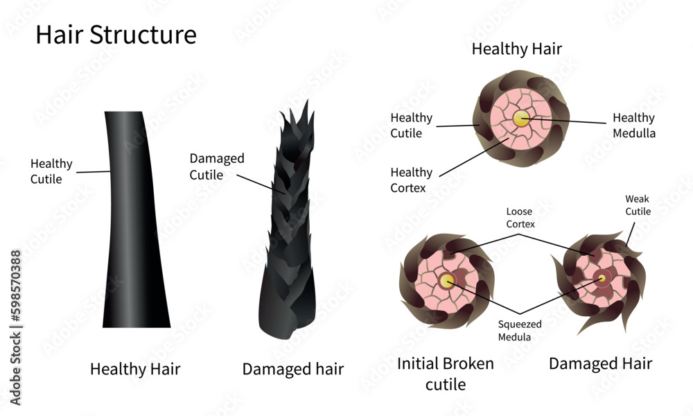 Vector de Stock Hair Growth Cycle, anagen, catagen, telogen, early ...