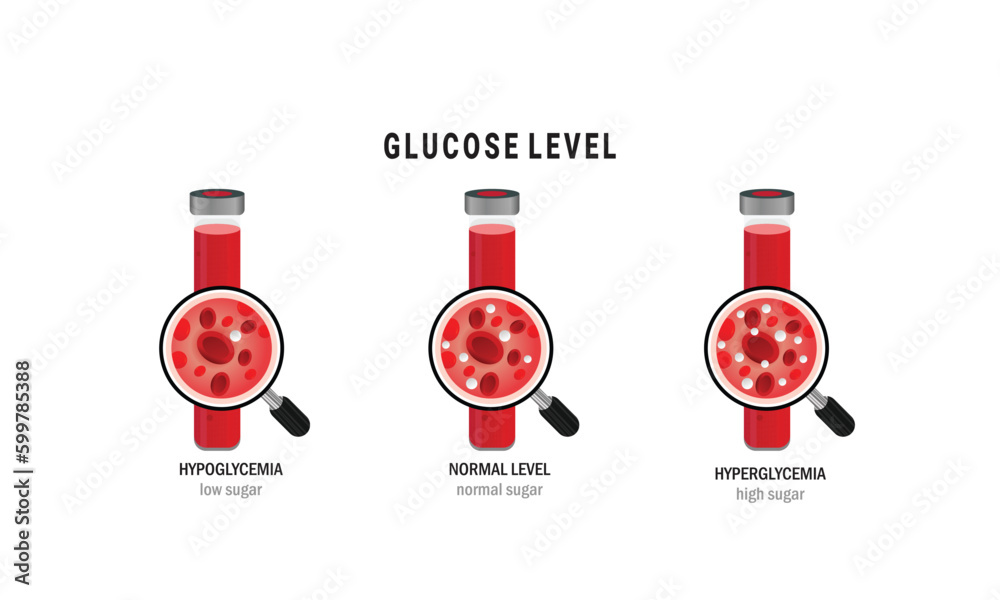 Glucose blood level sugar test. Diabetes insulin hypoglycemia or ...