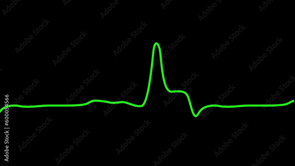 Pulse of the heartbeat green color. EKG Monitor. Heart beat cardiogram ...