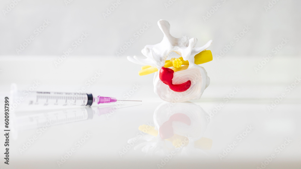 Anatomy model of human spine shows hnp and medical syringe with clean ...