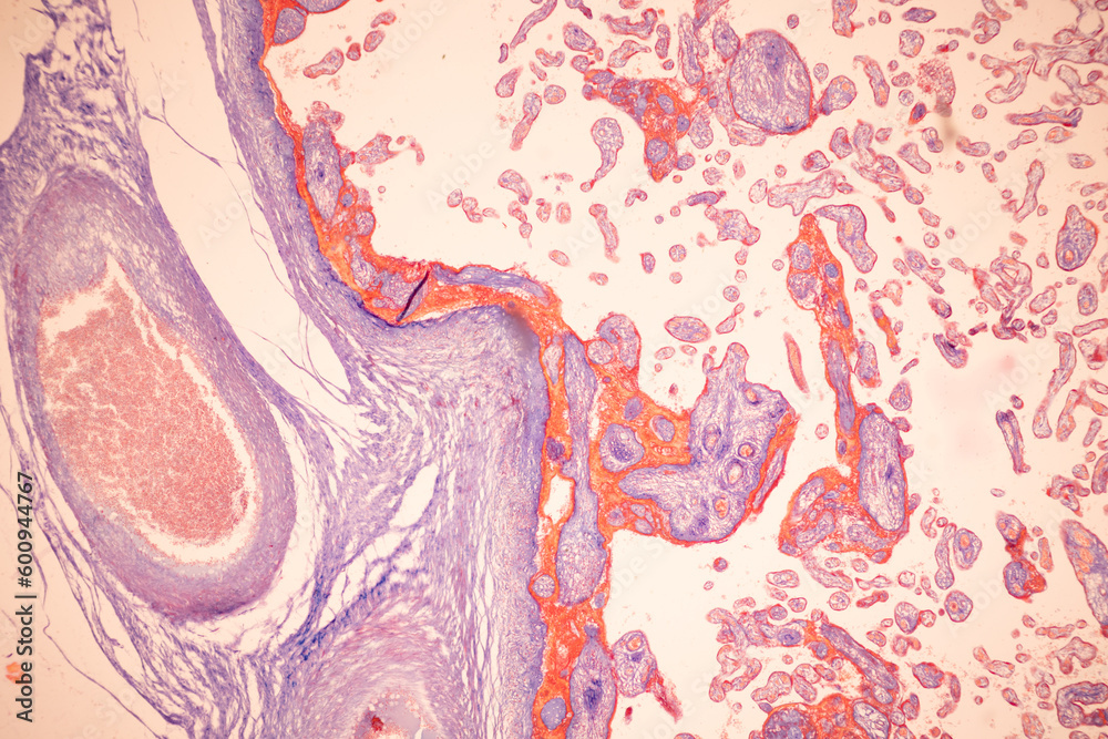 Histological Uterus human, Uterine tube human, Placenta human and ...