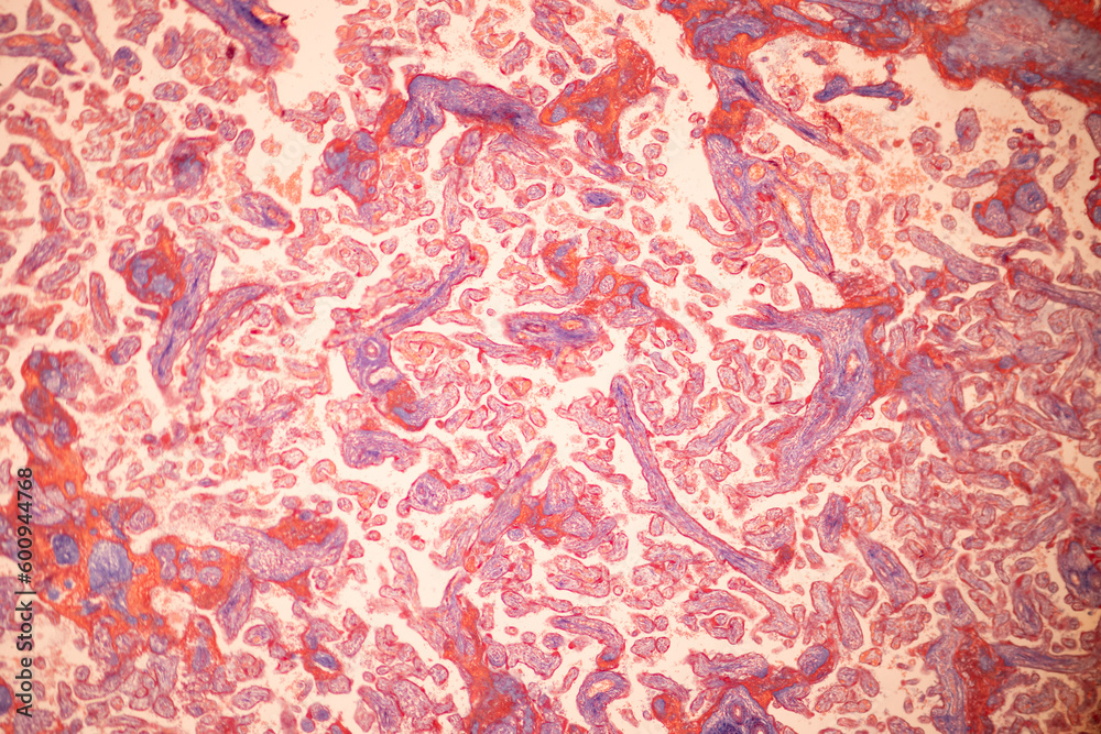 Stock-Foto „Histological Uterus human, Uterine tube human, Placenta ...