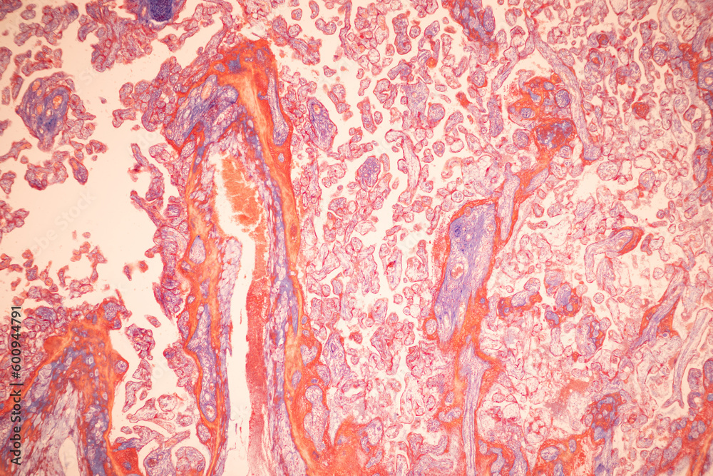 Histological Uterus human, Uterine tube human, Placenta human and ...