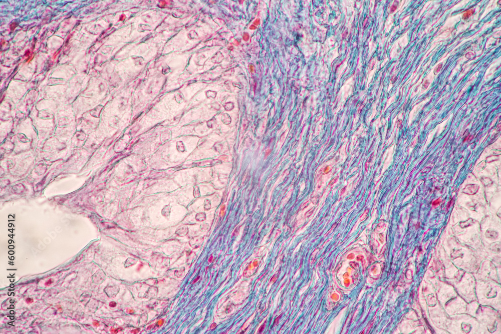 Histological Uterus human, Uterine tube human, Placenta human and ...