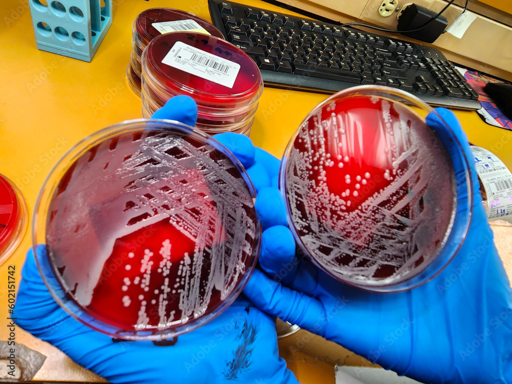 Staphylococcal bacterial colonies on blood agar culture plates Stock ...