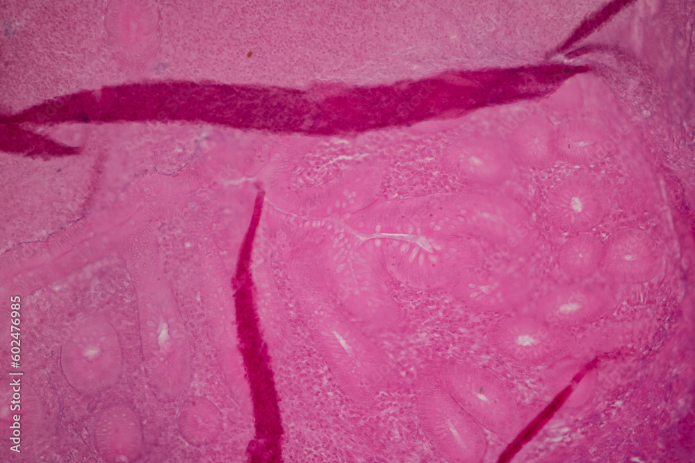 Foto de Stock Histological Pancreas human, Liver human, Vermiform ...