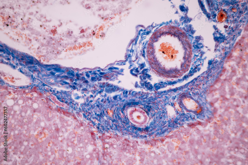 Histological Pancreas human, Liver human, Vermiform appendix human and ...