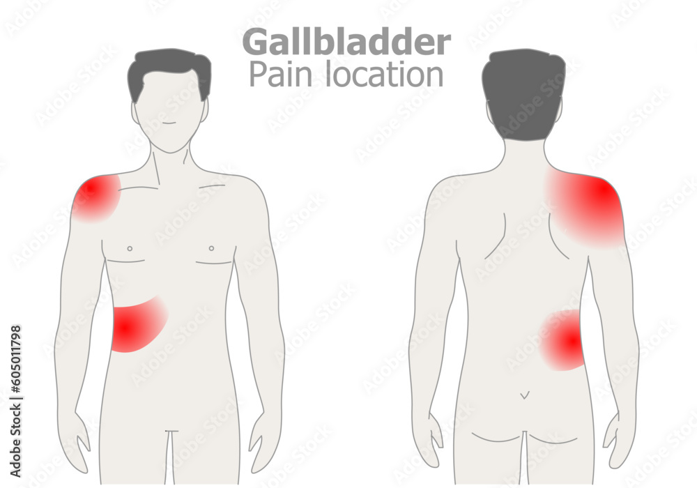 Gallbladder pain, attack location. Stones, cancer, polyps, tumors ...