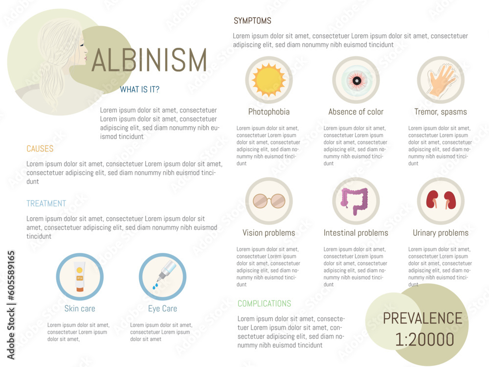 Infographic about albinism , what is symptoms and treatment with ...