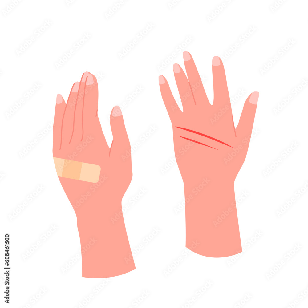 Human injured hands with band aid and wound infographic vector ...