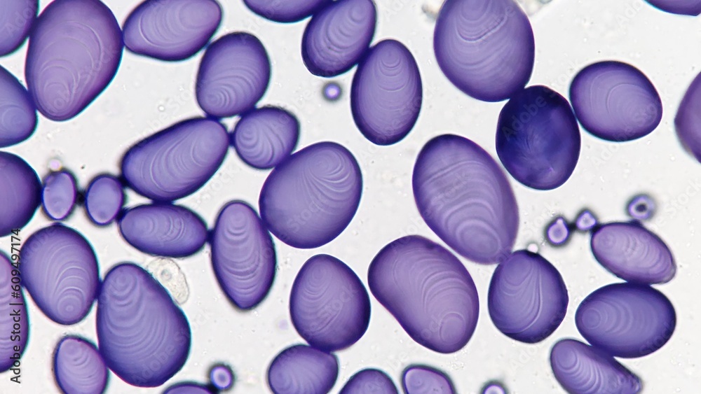 Starch grains of potato under microscope. 1000x magnification. Sample ...