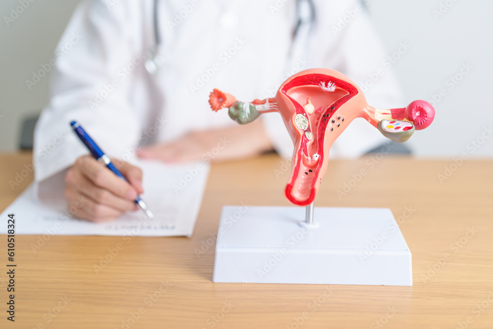 Doctor with Uterus and Ovaries anatomy model. Ovarian and Cervical ...