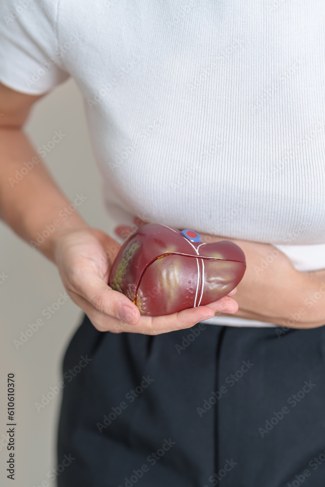 Woman holding human Liver anatomy model. Liver cancer and Tumor ...