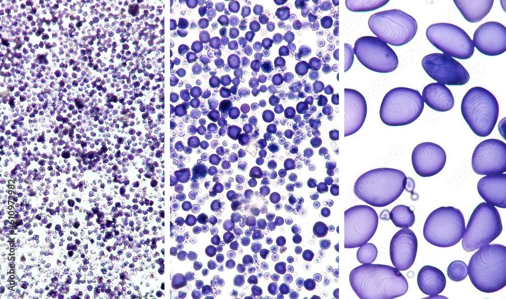 Starch grains of three carbohydrate sources in same magnification ...