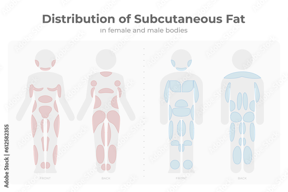 Subcutaneous fat distribution in men and women pictogram. Vector ...