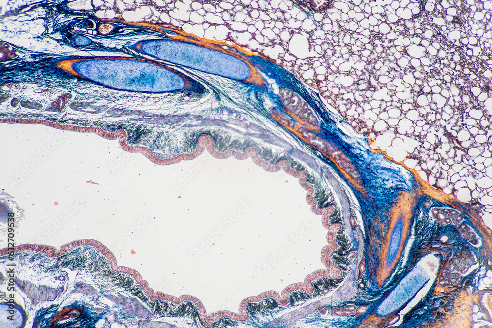 Human lung pathology under light microscope, The lungs is organs of the ...