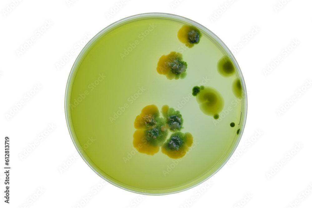 Colonies of different bacteria and mold fungi grown on Petri dish with ...