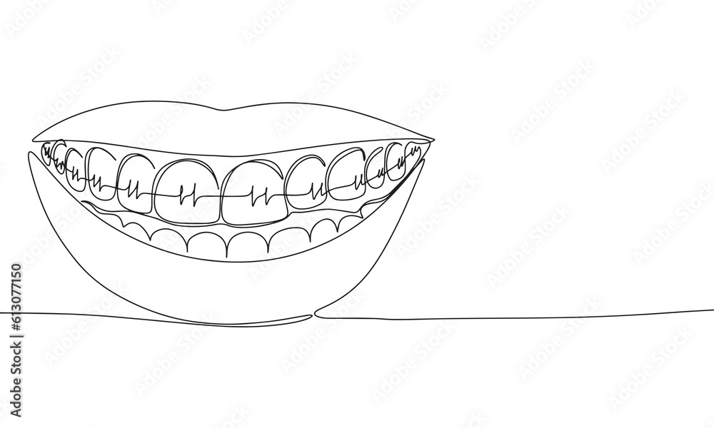 Continuous line drawing of braces for teeth. Vector illustration as ...