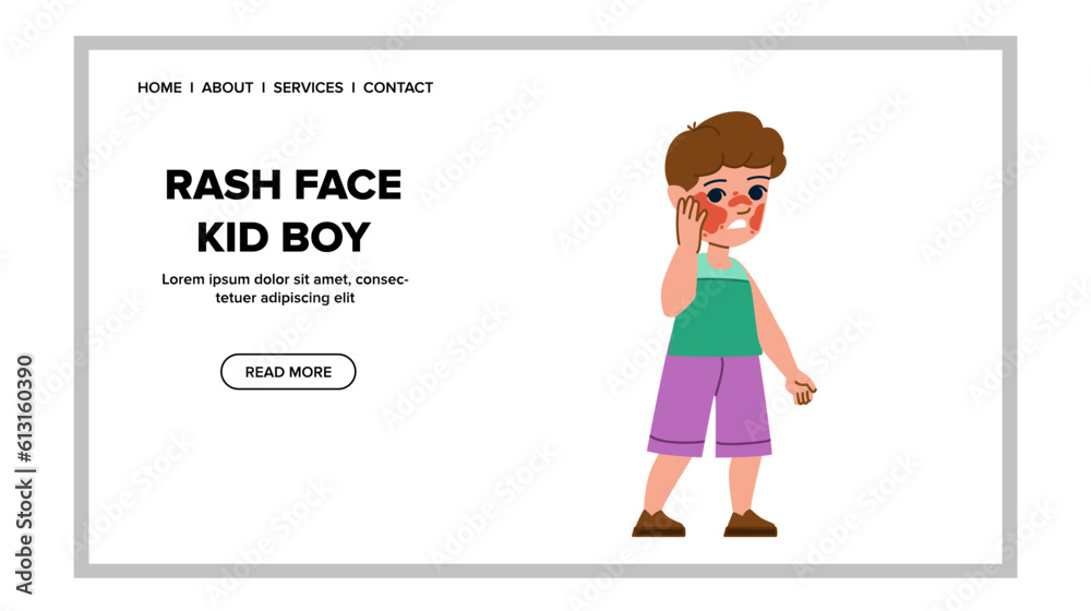 Image vectorielle Stock rash face kid boy vector. child health, disease ...
