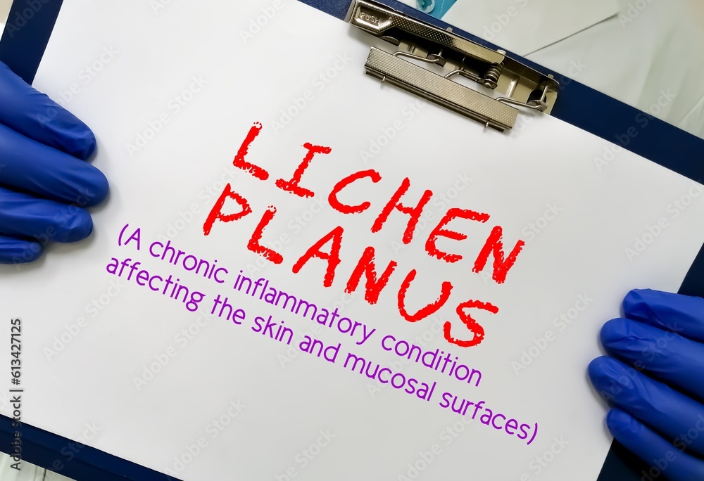 Medical conceptual image. LICHEN PLANUS, is a T-cell mediated ...