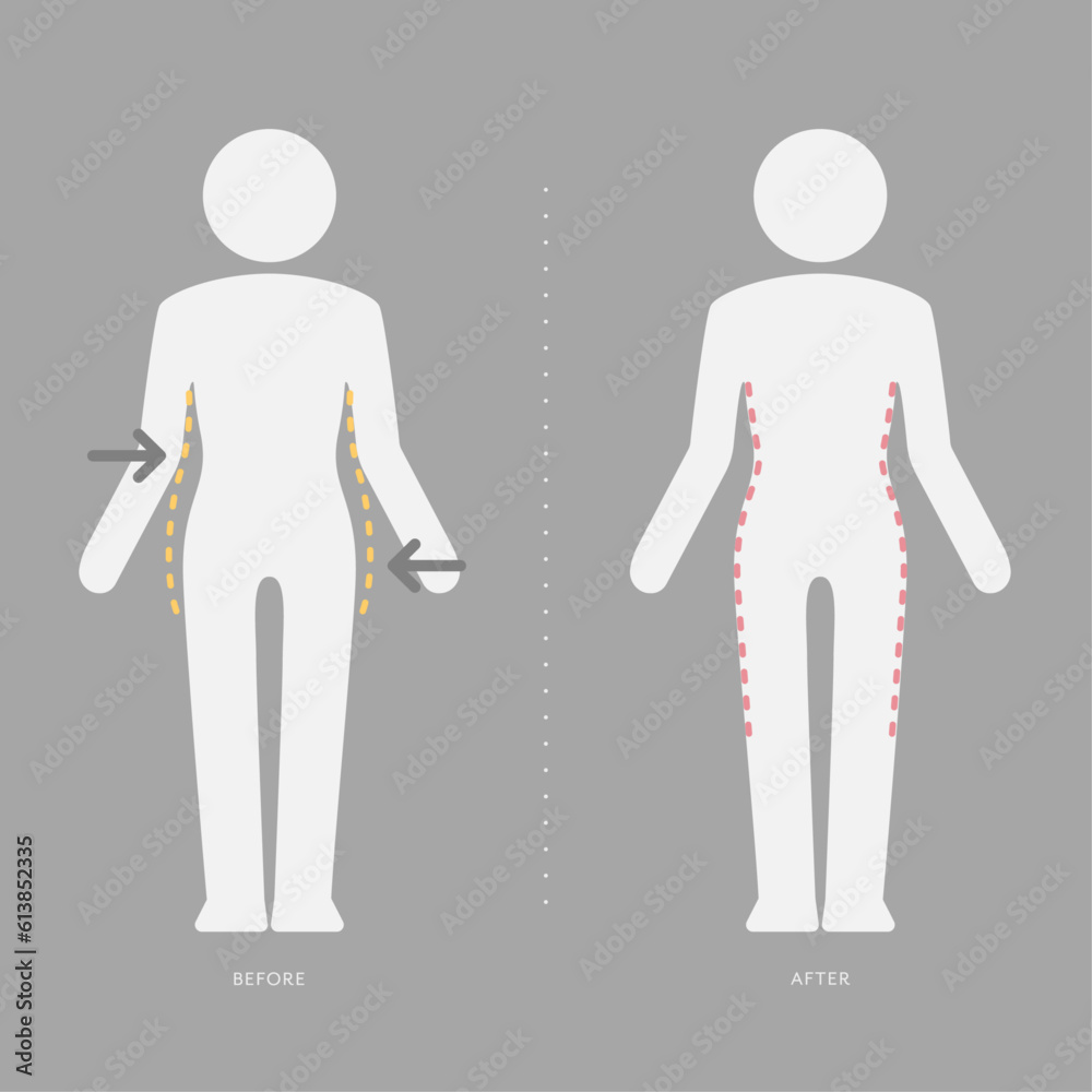 Woman body pictogram before and after losing weight .Yellow outline ...