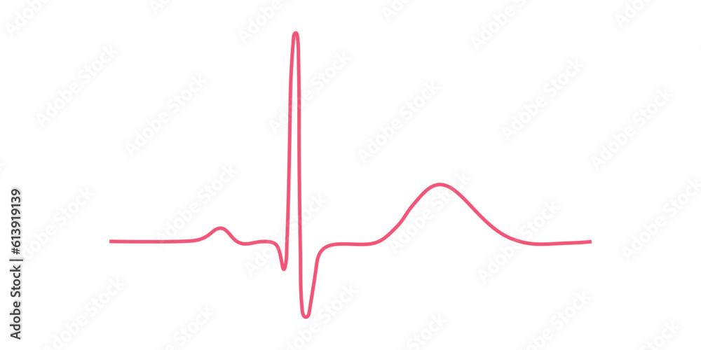 Ventricular repolarization, T wave. The QT interval of ECG. The cardiac ...