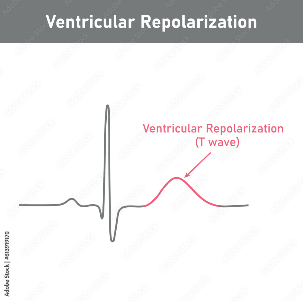 Ventricular repolarization, T wave. The QT interval of ECG. The cardiac ...