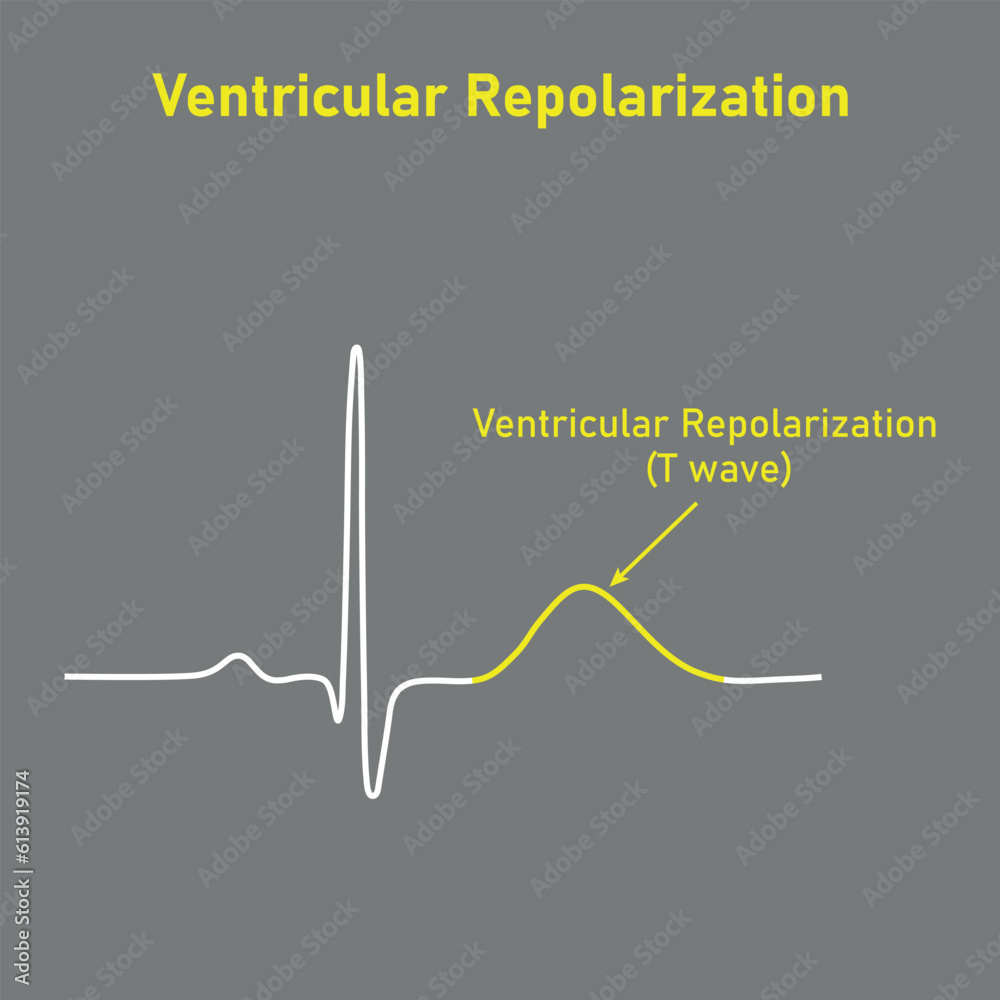 Ventricular repolarization, T wave. The QT interval of ECG. The cardiac ...