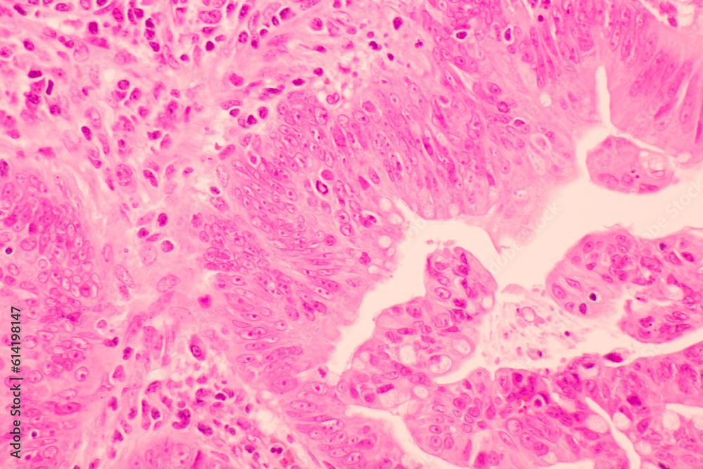 Ilustração Backgrounds of human cells tissue of lung human under the ...