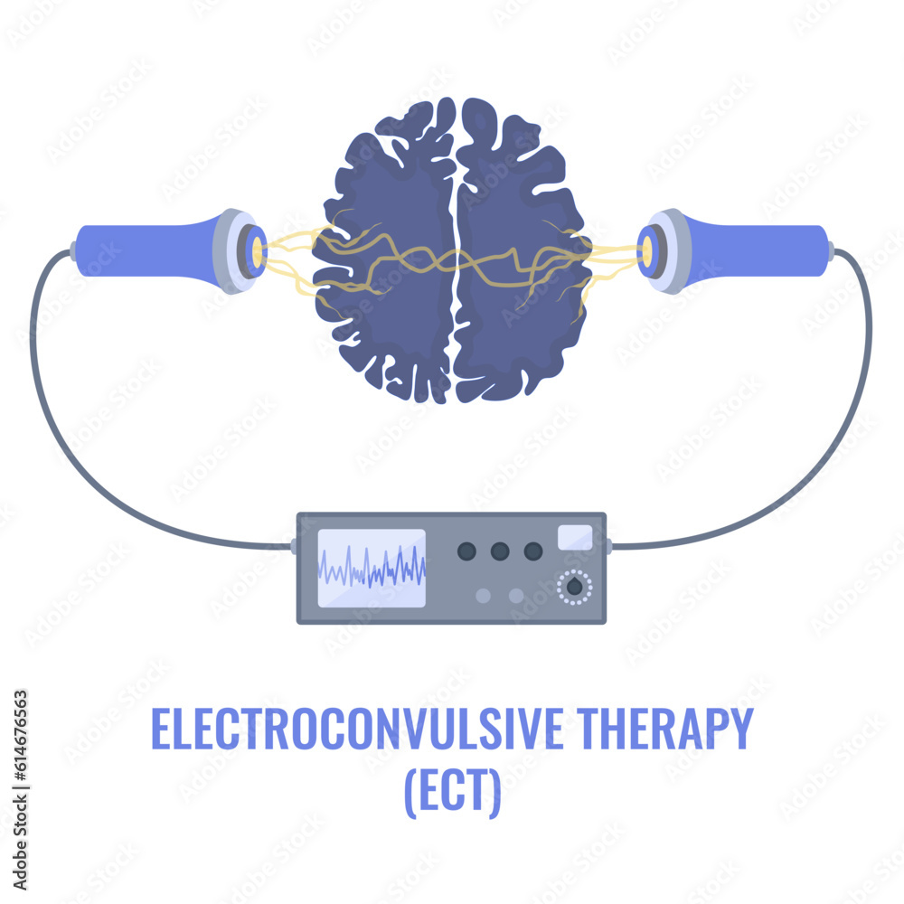Electroconvulsive therapy for severe depression and schizophrenia ...