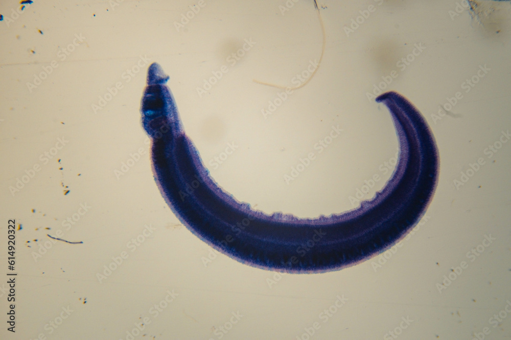 Foto de Stock Parasites Under Microscope Display Unique Morphology and ...