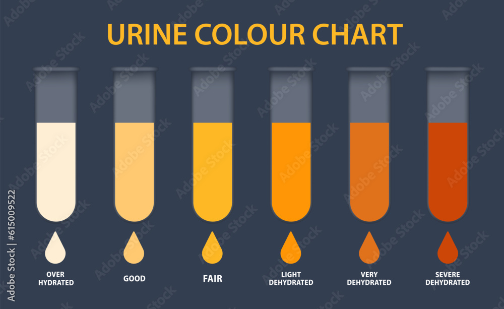 Urine colour chart. Hydration and dehydration level diagram. Medical ...