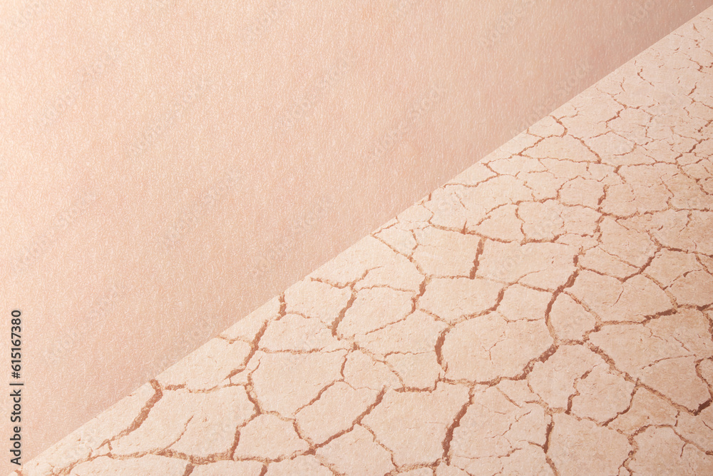 Before and After close-up on dry woman skin texture with dry dessert ...