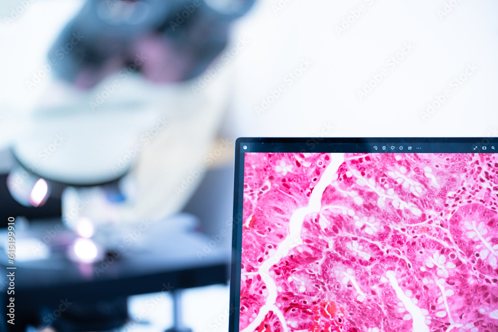 Modern microscope and human tissue section slide with computer monitor ...
