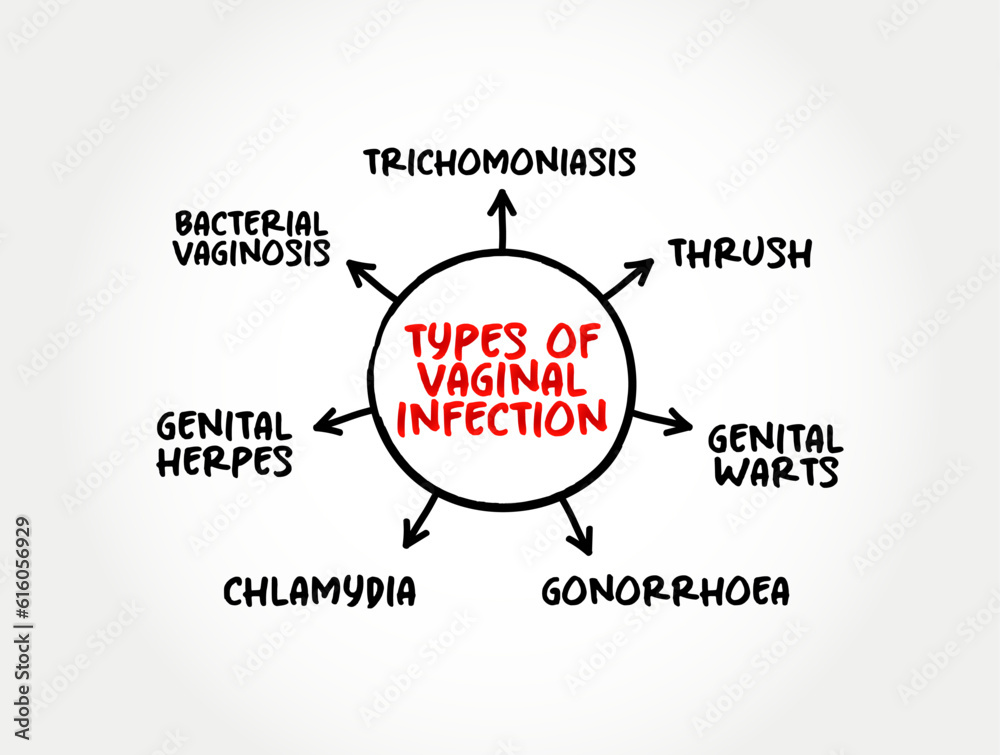 Types of vaginal infection mind map, text concept for presentations and ...
