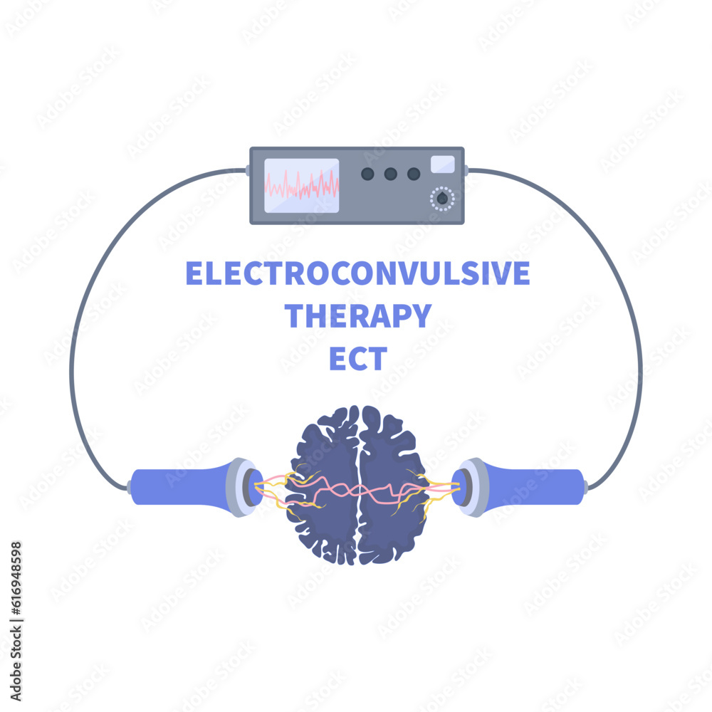 Electroconvulsive therapy for severe depression and schizophrenia ... Electroconvulsive therapy for severe depression and schizophrenia ...