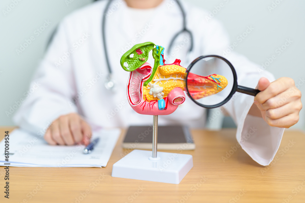 Doctor with human Pancreatitis anatomy model with Pancreas, Gallbladder ...