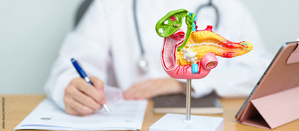 Doctor with human Pancreatitis anatomy model with Pancreas, Gallbladder ...