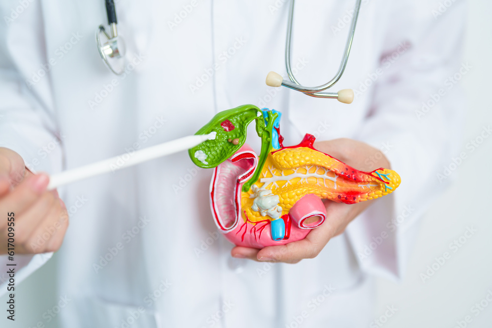 Doctor with human Pancreatitis anatomy model with Pancreas, Gallbladder ...